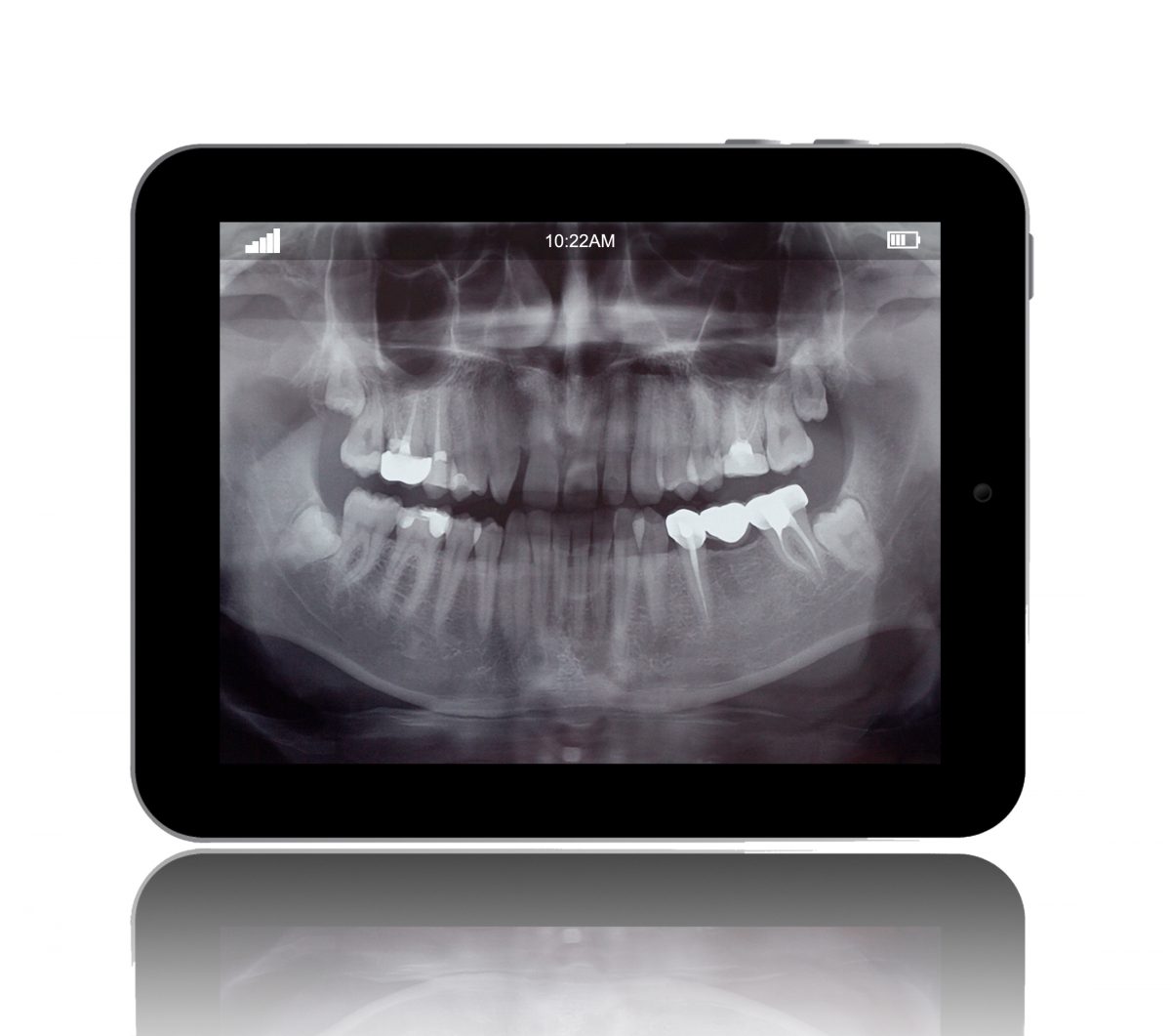 Dental Technology - Lindsey A Robinson DDS - Grass Valley, CA